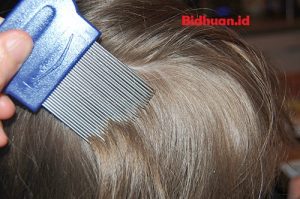 5 Cara Menghilangkan Kutu Rambut dan Telurnya Sampai Bersih - Berbagi ...